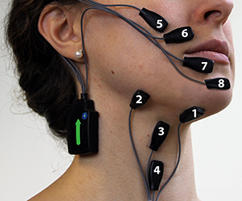 EMG Voice; How electromyography is giving a voice to those who cannot ...