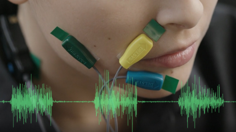 Delsys Europe | Wearable EMG Sensors for Movement Sciences